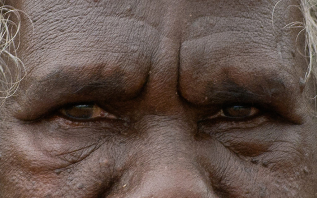 Indigenous eye health: time for government to put money up | InSight+