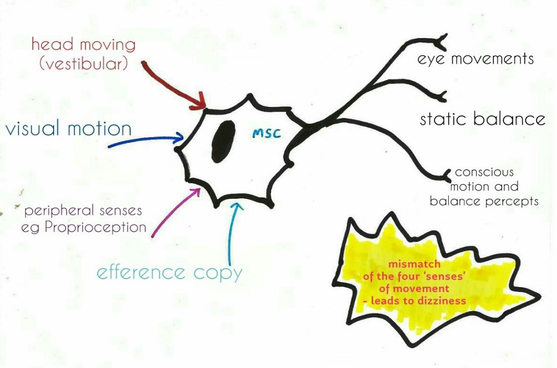 Dizziness explained, part 1: how it arises | InSight+