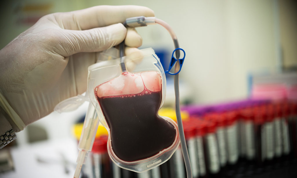 Oldest-available blood safe, but how old is too old? | InSight+