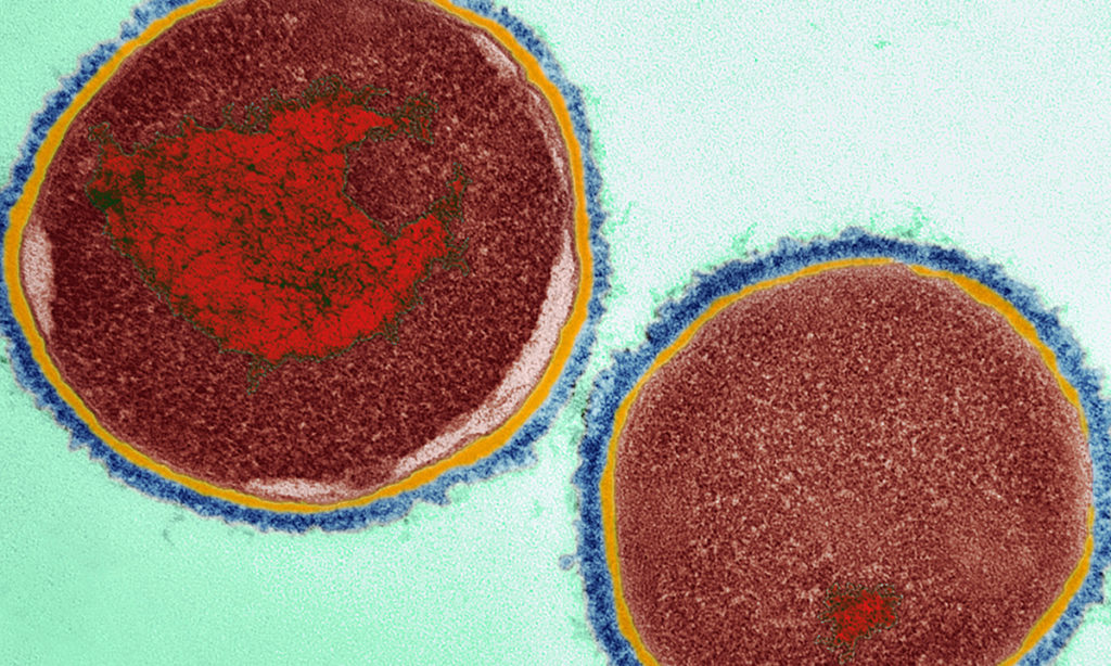 Skin sores in Indigenous children “normalised” | InSight+